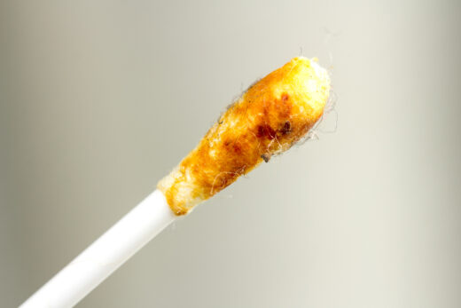 Dog Earwax Color Chart: Everything You Need To Know